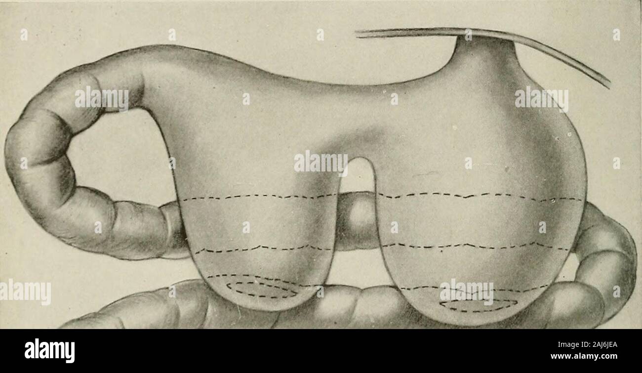 Surgical treatment; a practical treatise on the therapy of surgical ...