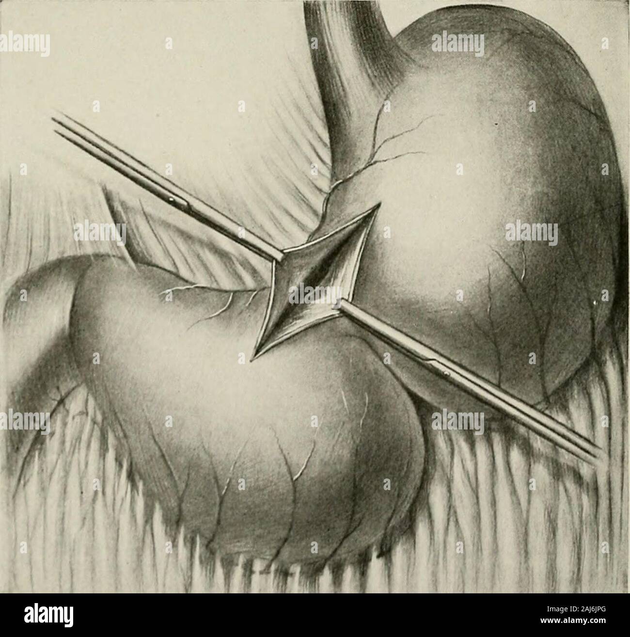 Surgical treatment; a practical treatise on the therapy of surgical ...