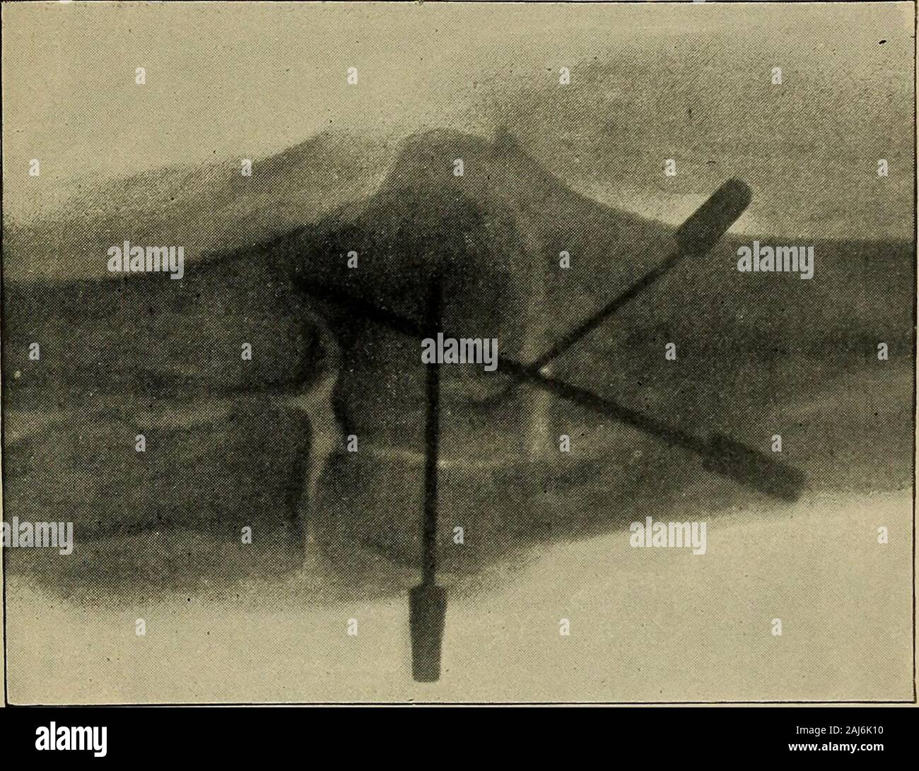 Notes on the modern treatment of fractures . Fig. 11. Experimental ...