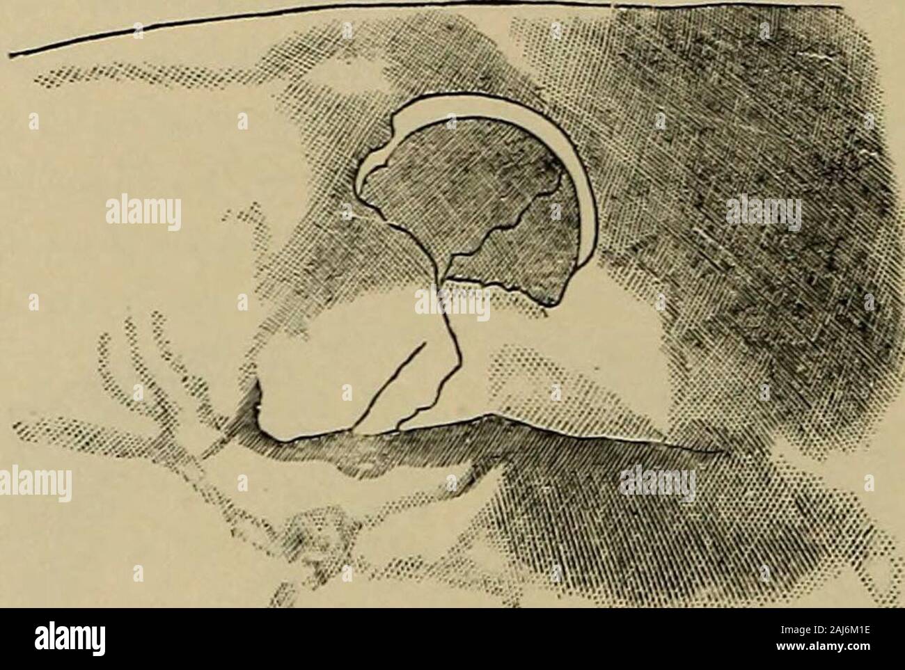 Cadaver study hi-res stock photography and images - Alamy