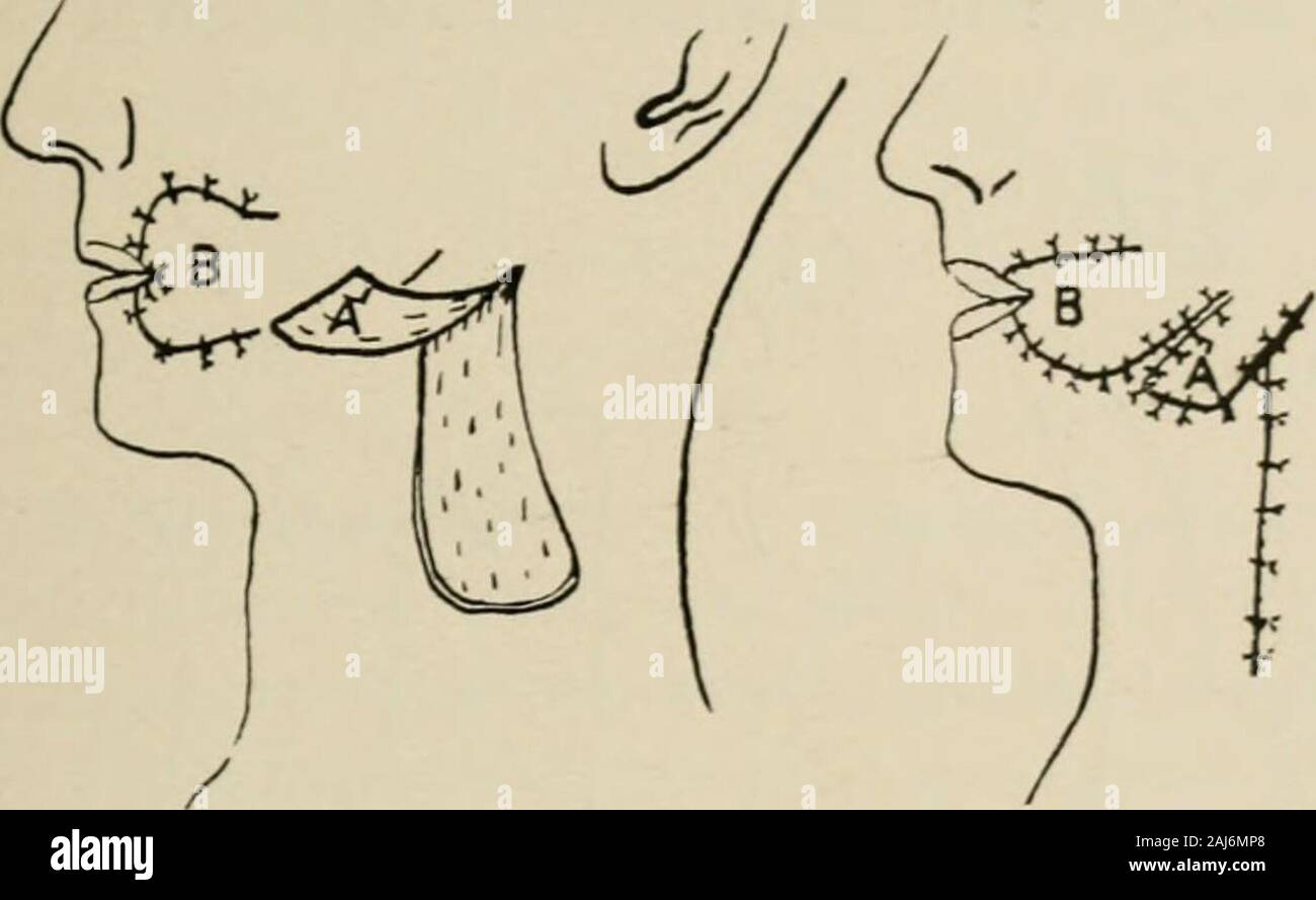 Flap closing hi-res stock photography and images - Alamy