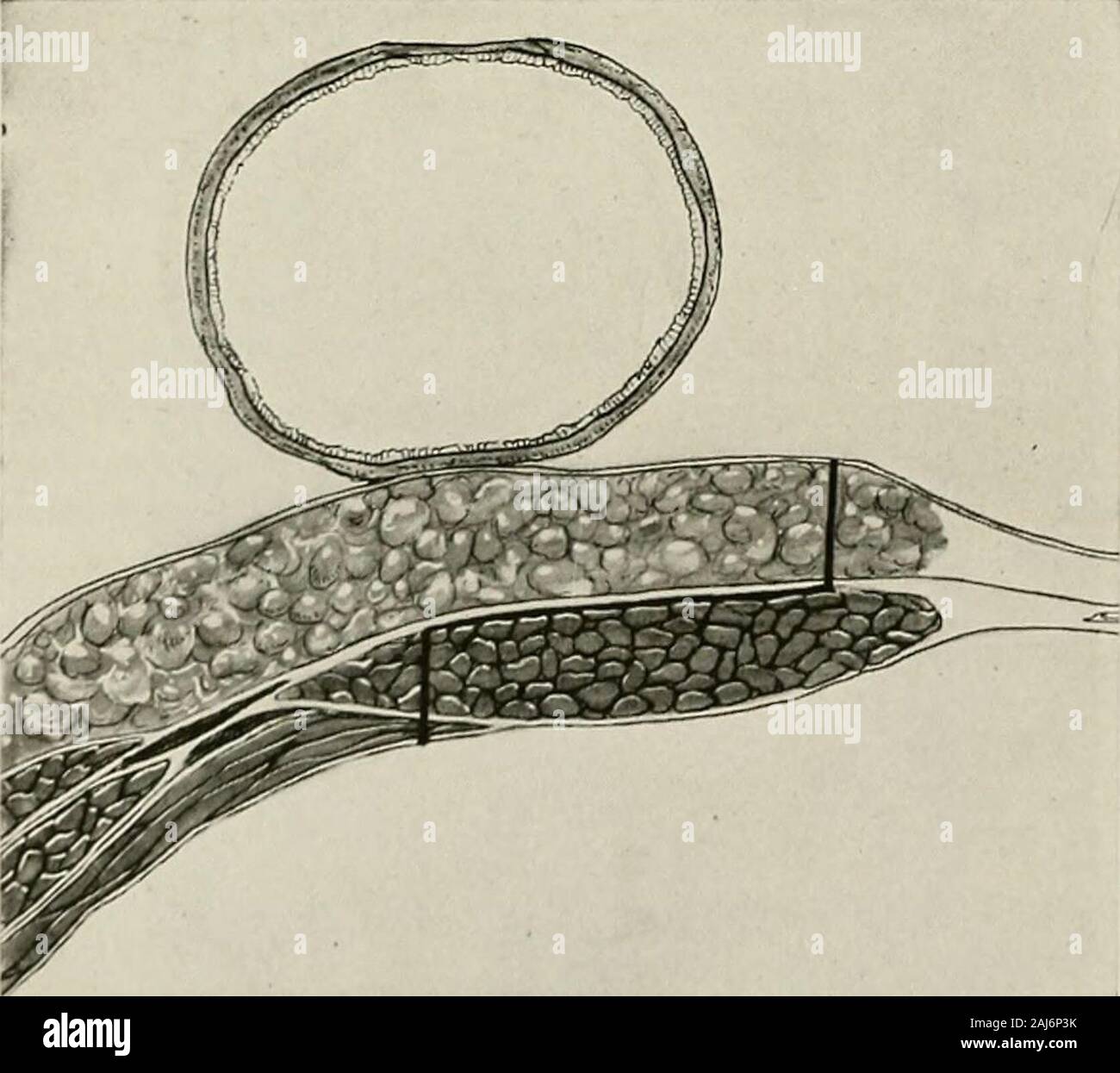 Surgical treatment; a practical treatise on the therapy of surgical ...