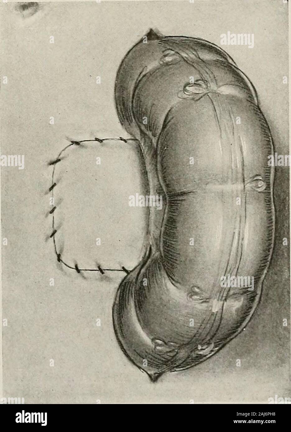 Surgical treatment; a practical treatise on the therapy of surgical ...