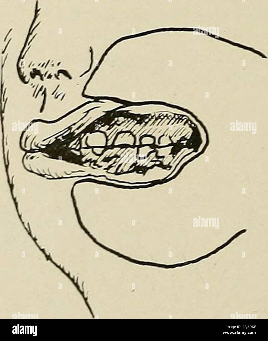 Plastic surgery; its principles and practice . growth is removed, or ...