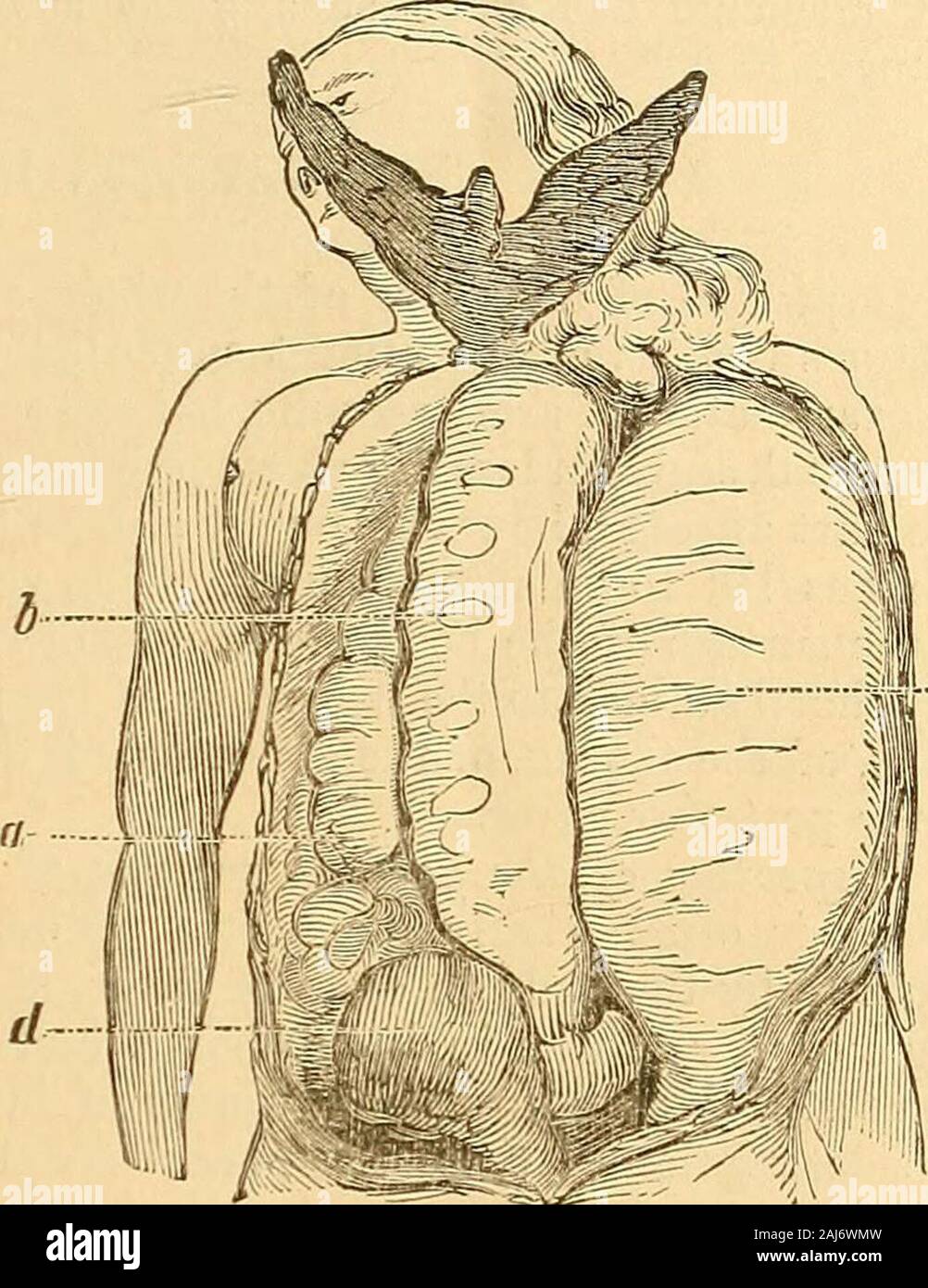 Position of the viscera hi-res stock photography and images - Alamy