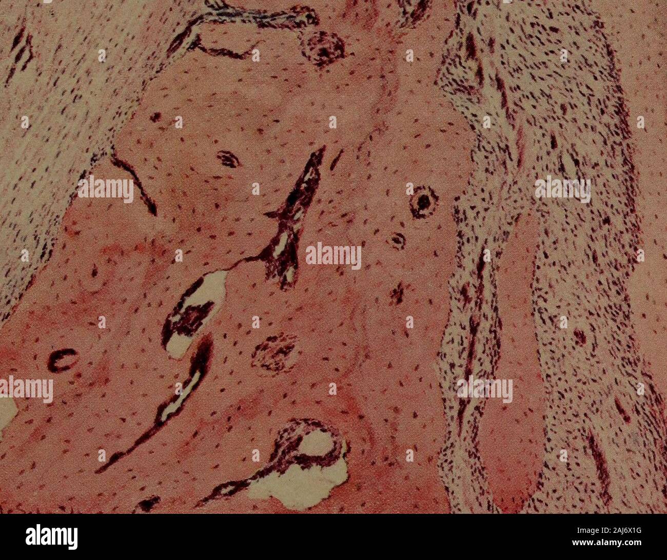 Alveolar process hi-res stock photography and images - Alamy