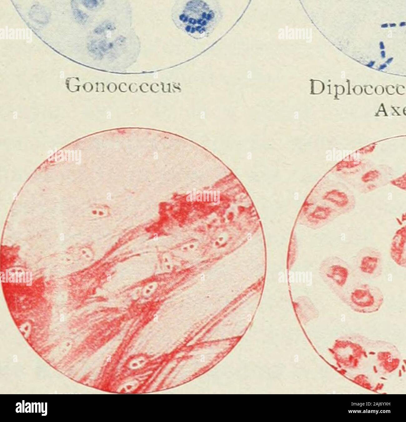 Haemophilus Ducreyi School Of Fish