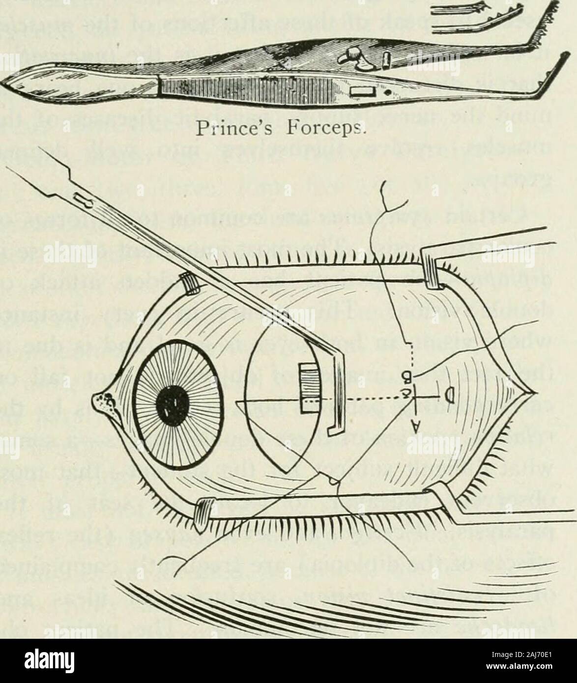 The commoner diseases of the eye : how to detect and how to treat them ...