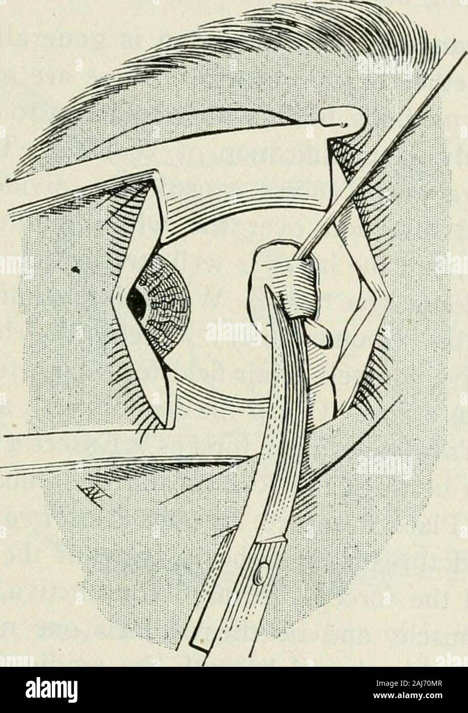 The commoner diseases of the eye : how to detect and how to treat them ...