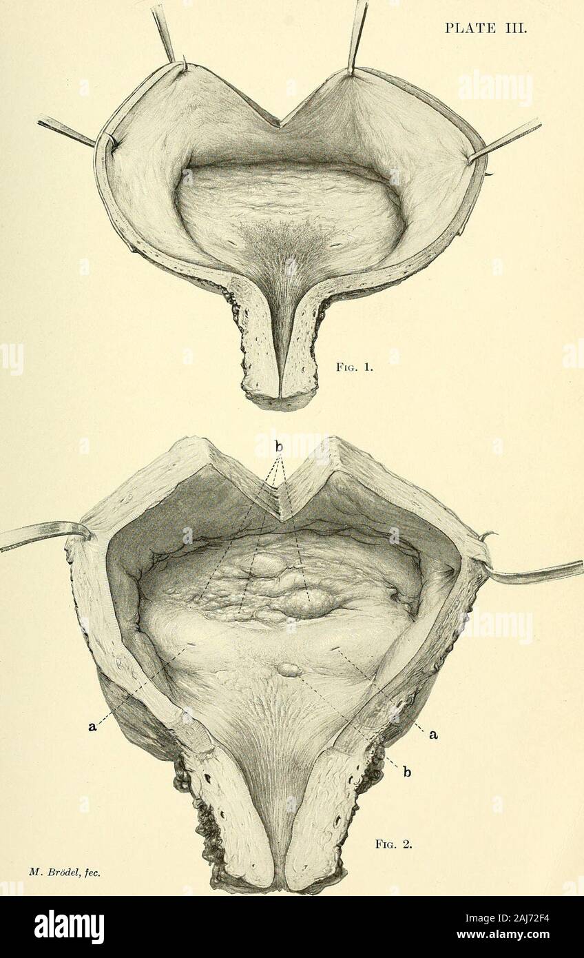 Operative gynecology : . the1* fo j&sttM^?gfe ortfelgonum; thethird ...