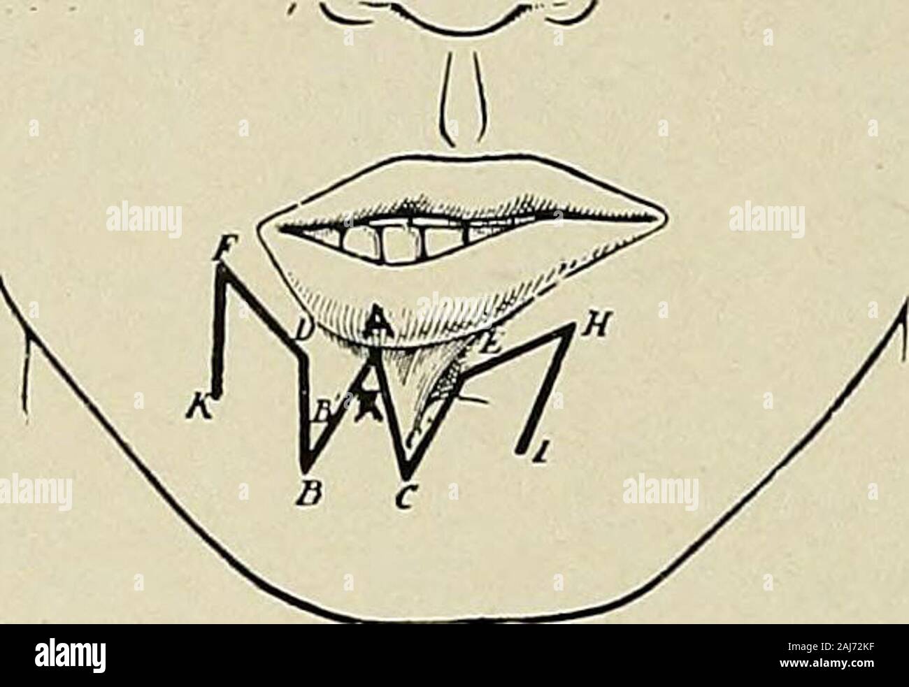 Plastic surgery; its principles and practice . for the relief of ...