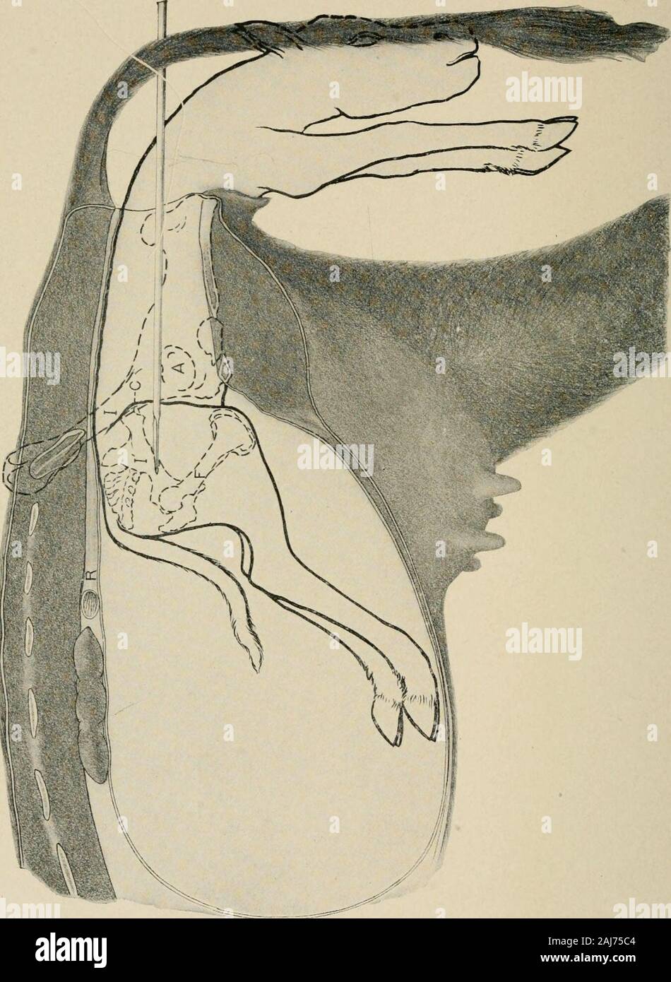 Fetal thorax hi-res stock photography and images - Alamy