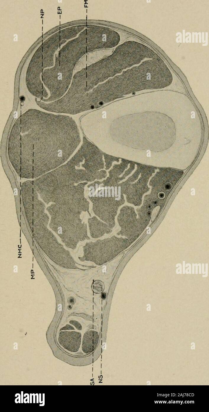 Surgical and obstetrical operations . Pirate XXXII.Anterior Tibiai ...