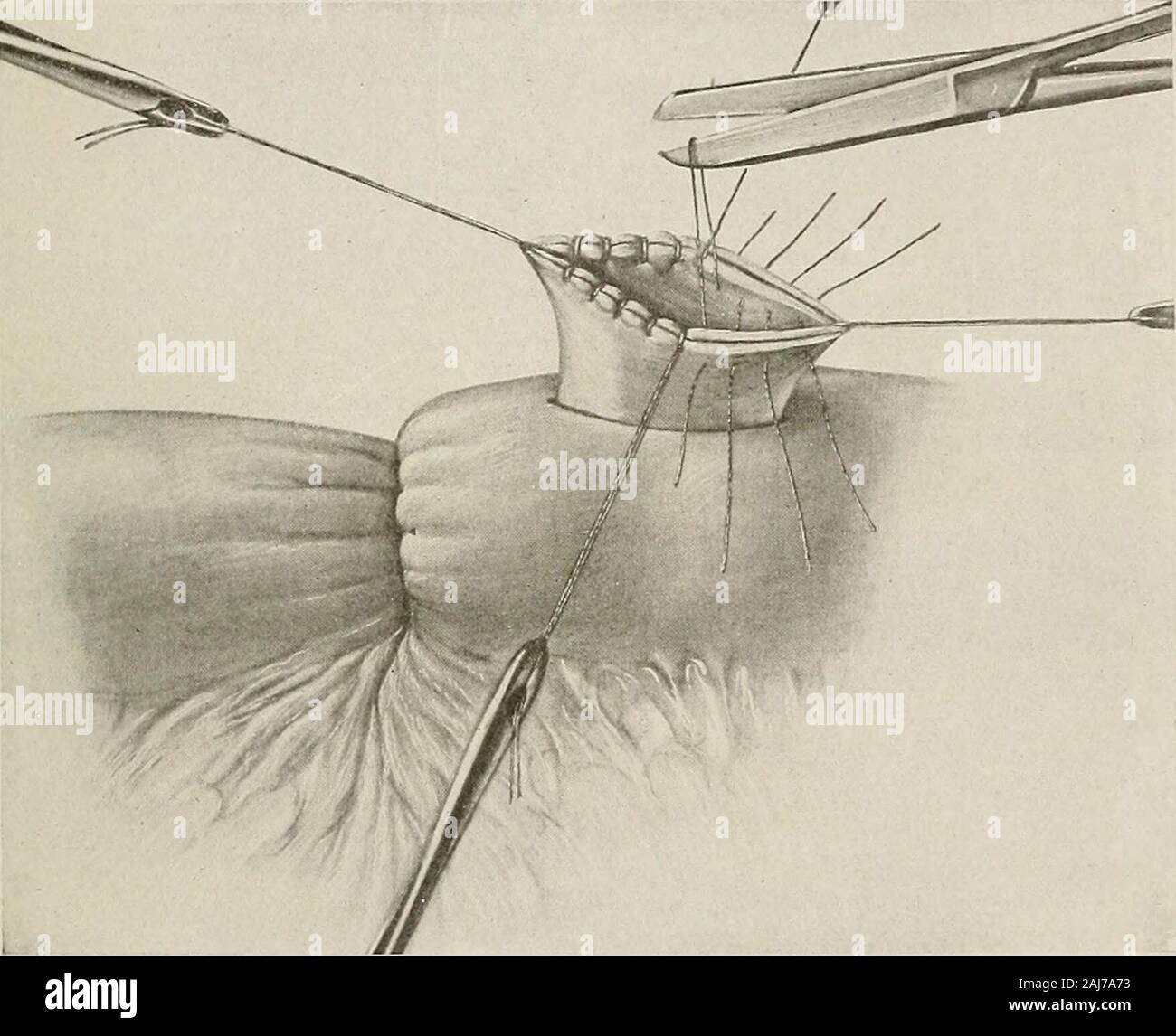Surgical treatment; a practical treatise on the therapy of surgical ...