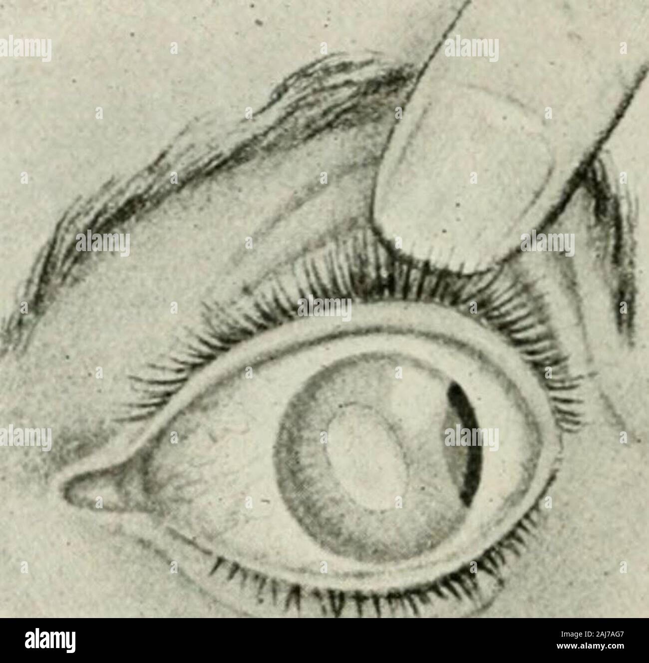 The commoner diseases of the eye : how to detect and how to treat them ...