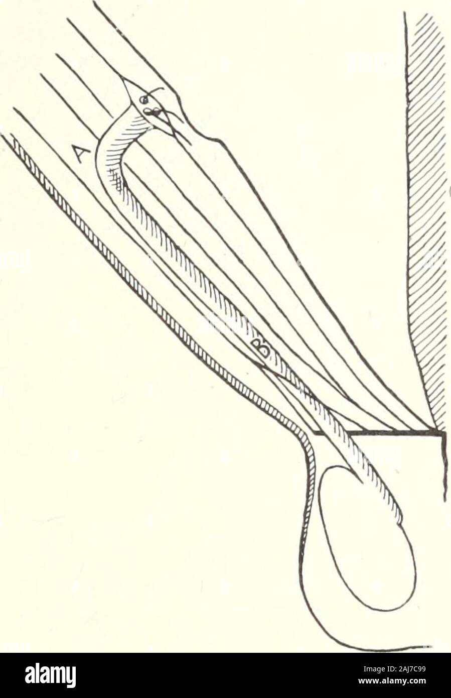 Subcutaneous tissue and muscles hi-res stock photography and images - Alamy