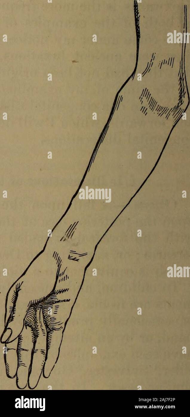 Pronation arm hi-res stock photography and images - Alamy