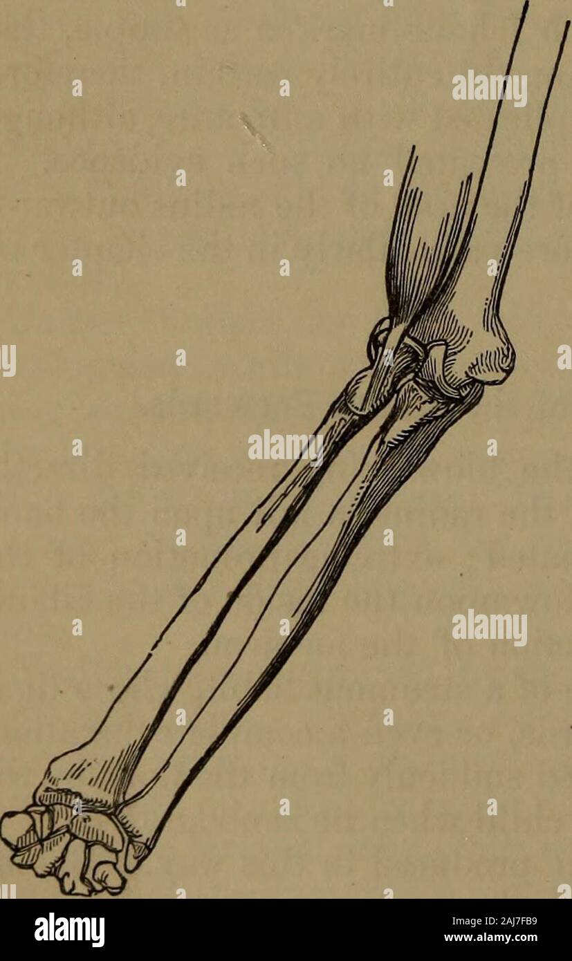 Annular ligament of radius hi-res stock photography and images - Alamy