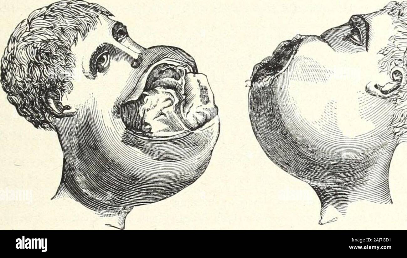 The medical age : a semi-monthly journal of medicine and surgery . f ...