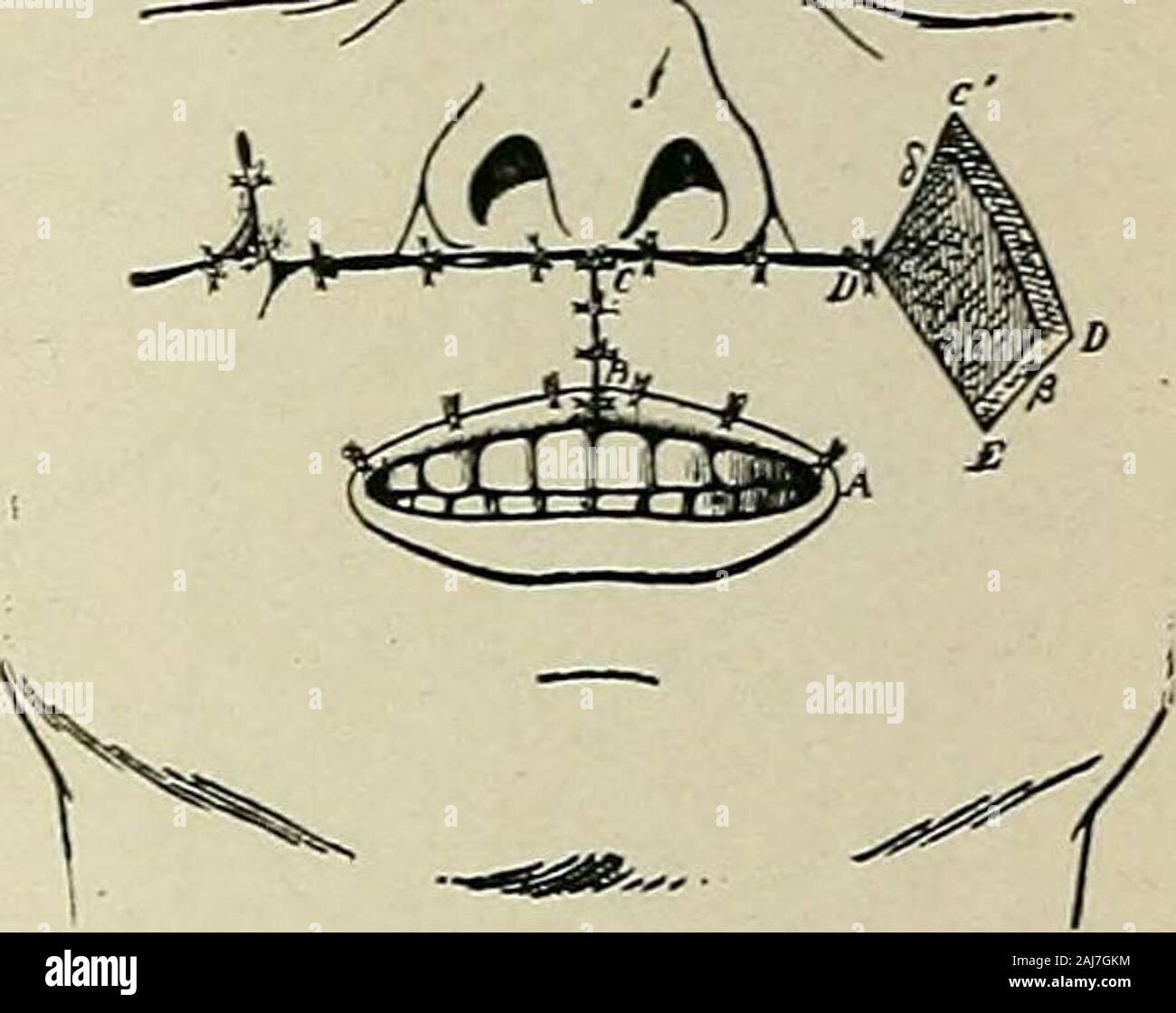 Ombredanne hi-res stock photography and images - Alamy