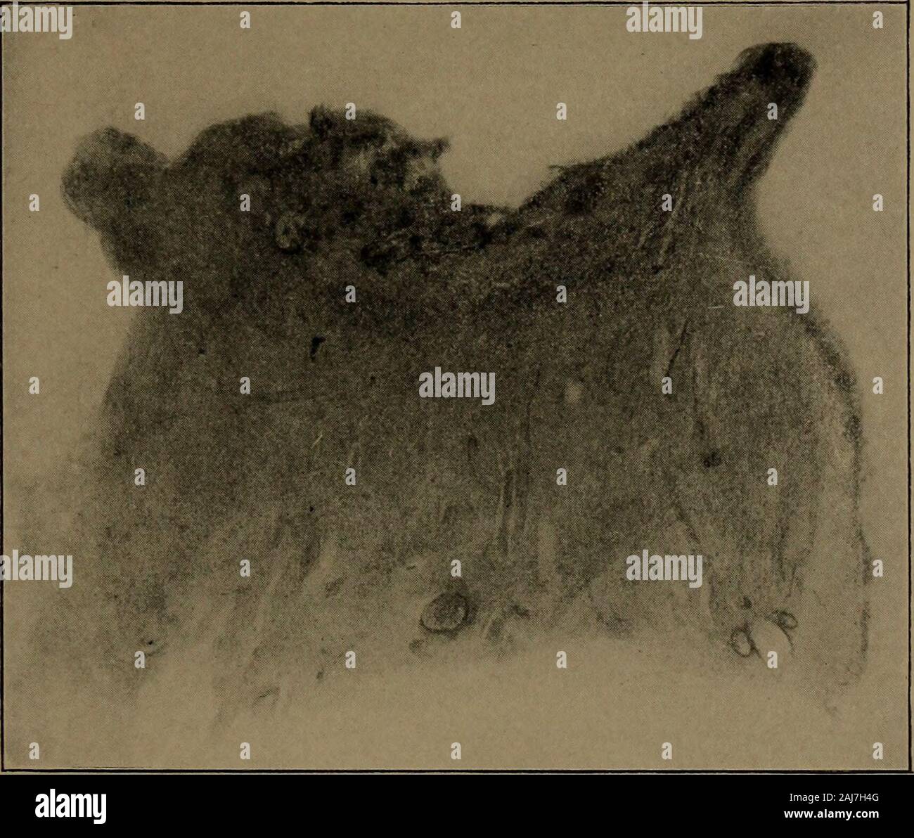 Diapedesis Histology