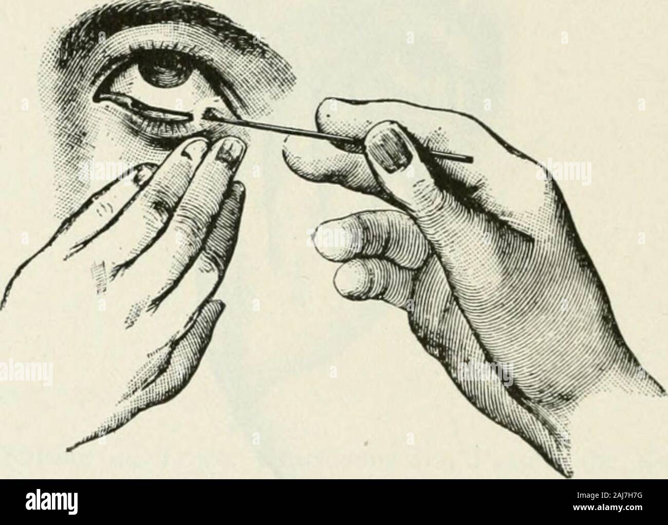 The commoner diseases of the eye : how to detect and how to treat them ...