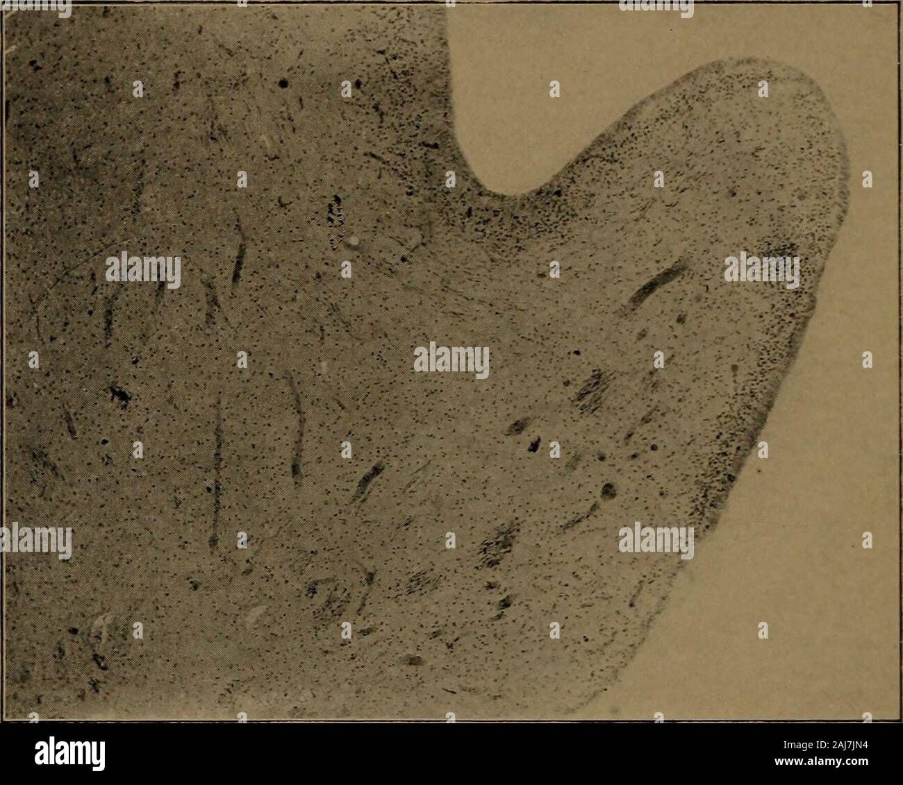 Calcified tissue hi-res stock photography and images - Alamy