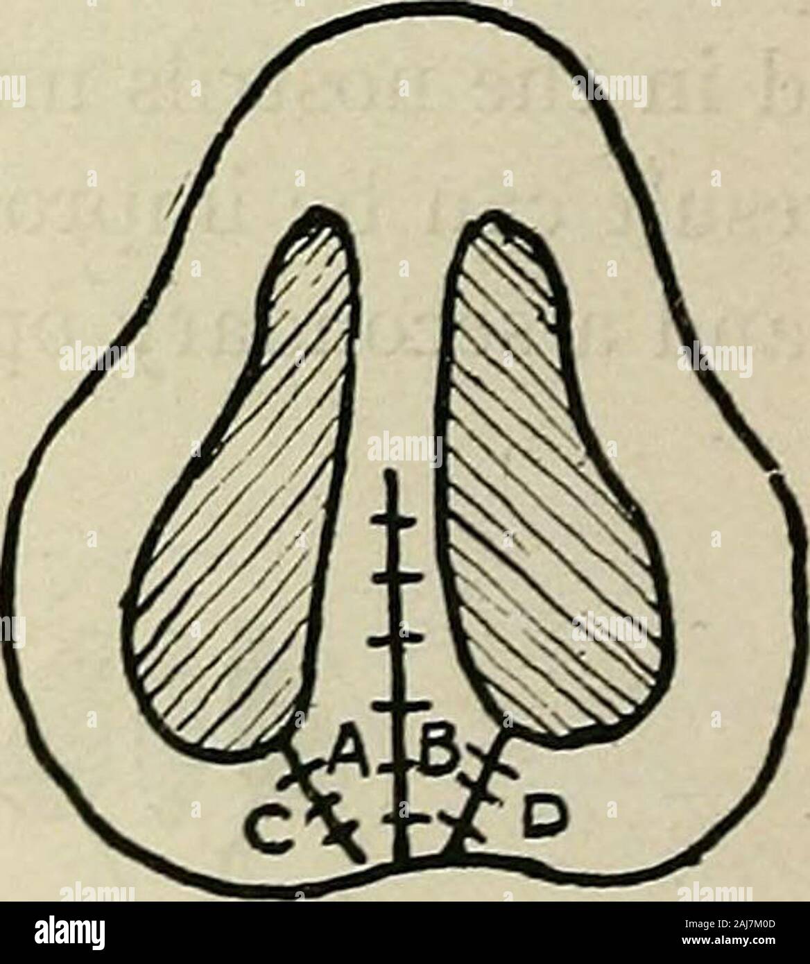 Inverted y hi-res stock photography and images - Alamy
