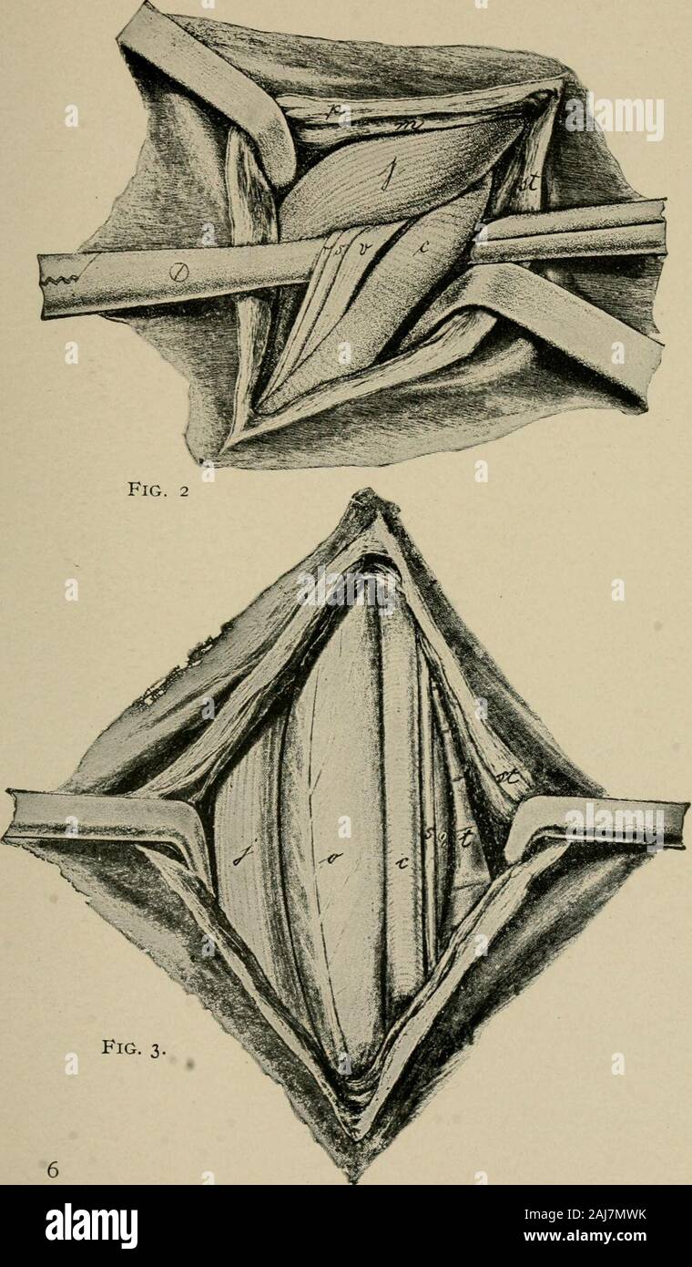 Toothed forceps hi-res stock photography and images - Alamy