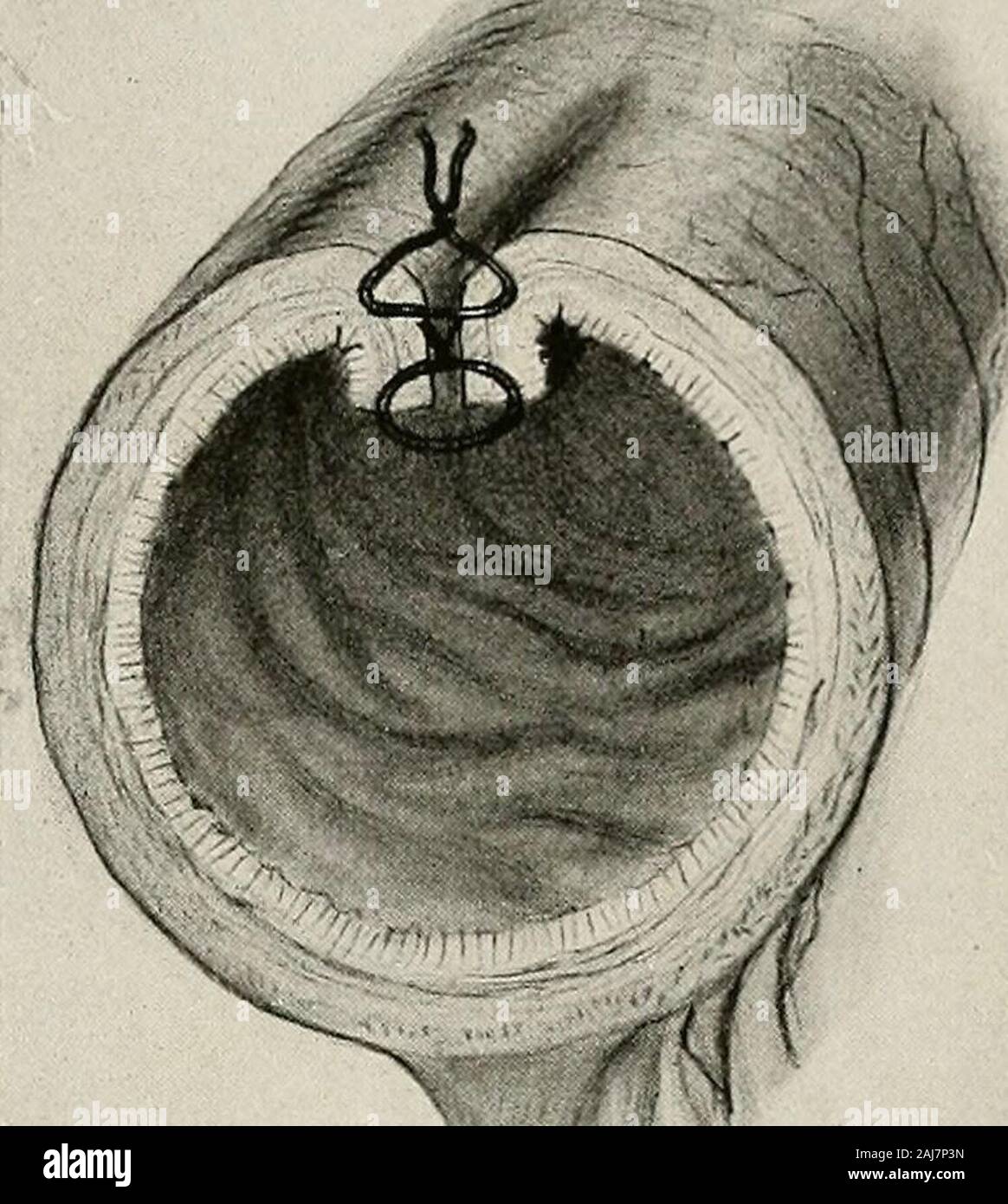 1285 1286 hi-res stock photography and images - Alamy