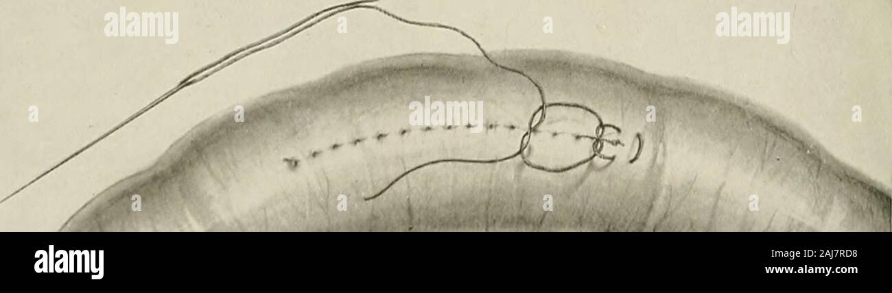 Surgical treatment; a practical treatise on the therapy of surgical ...