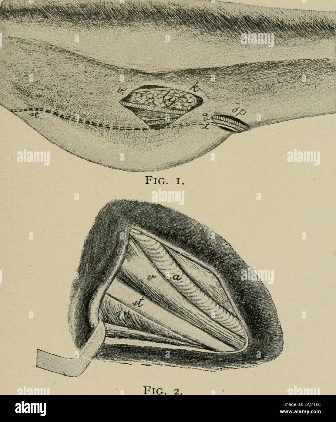Surgical and obstetrical operations . be to remove all diseasedparts ...