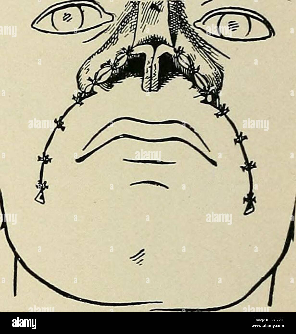 Cheek flaps hi-res stock photography and images - Alamy