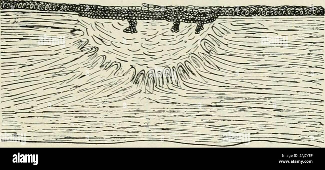 Corneal epithelium hi-res stock photography and images - Alamy
