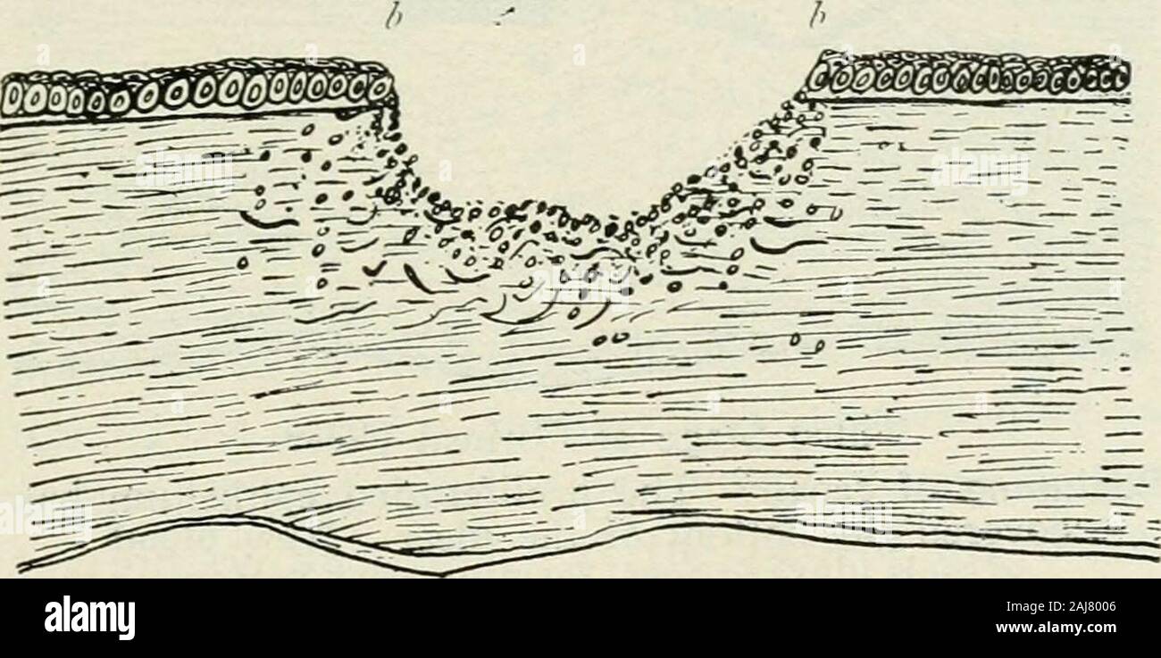 Conjunctival sac hi-res stock photography and images - Alamy