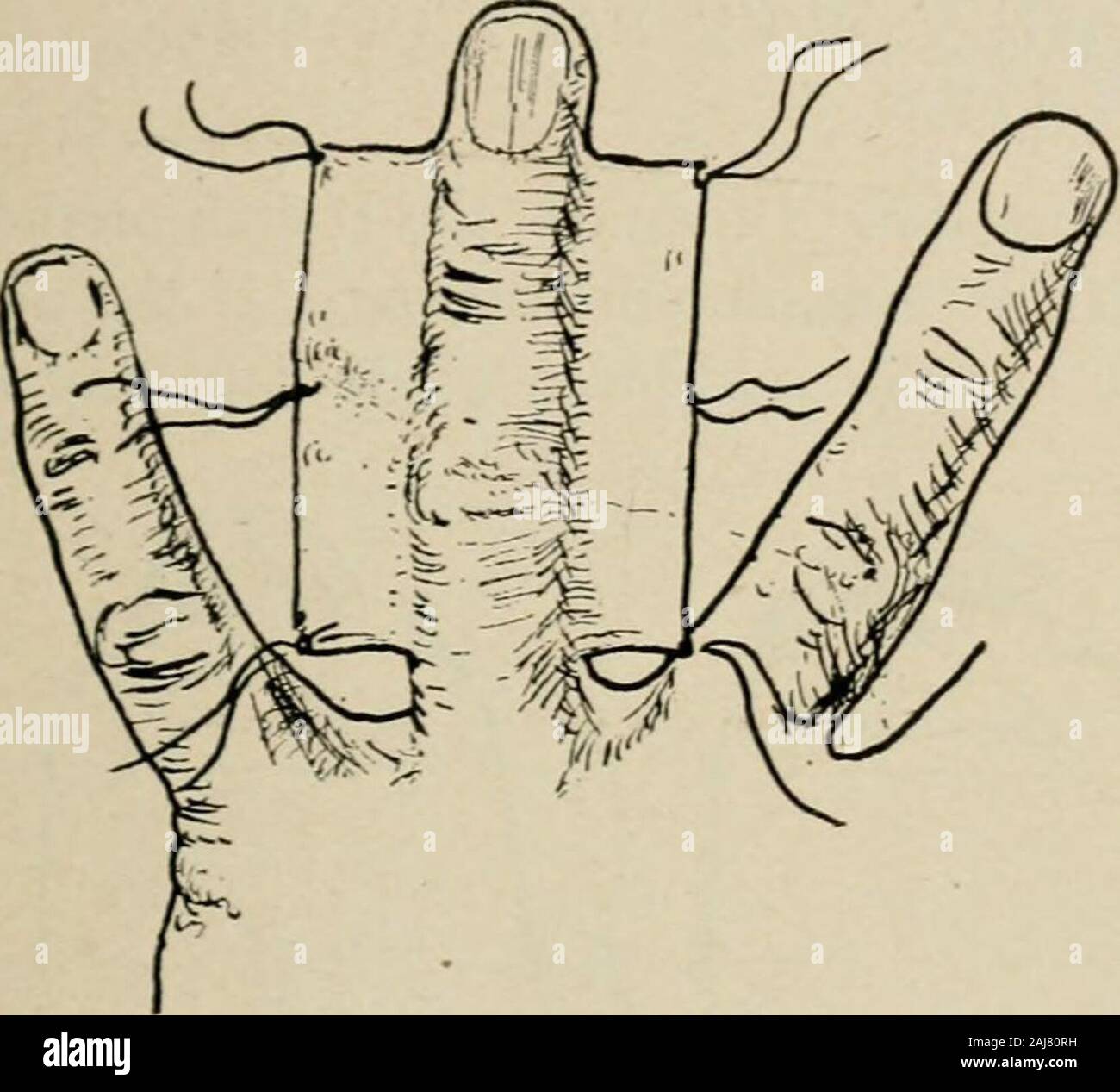 Plastic surgery; its principles and practice . y are granulating.2. The ...