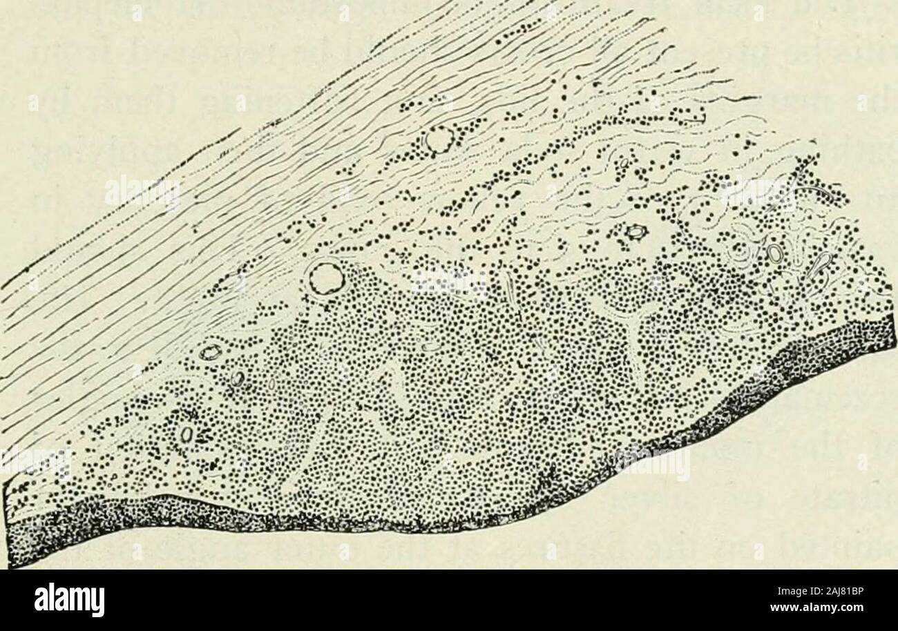 The commoner diseases of the eye : how to detect and how to treat them ...
