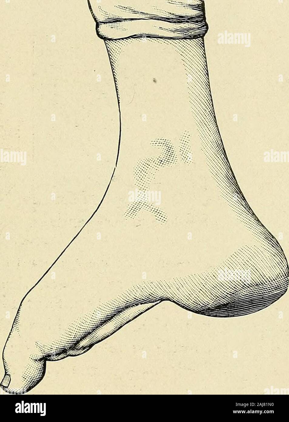 Plantar flexion hi-res stock photography and images - Alamy