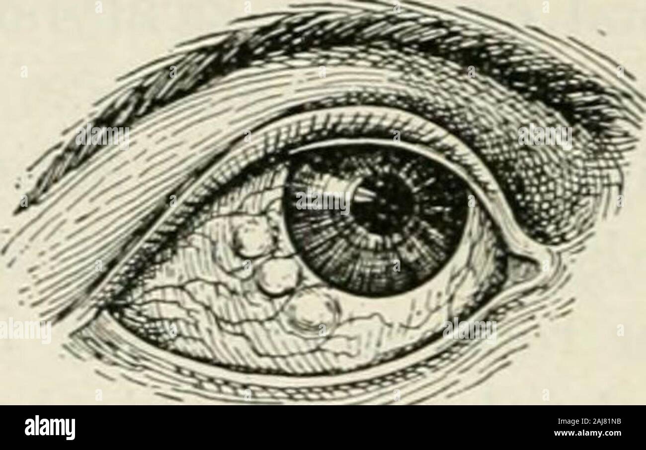 The commoner diseases of the eye : how to detect and how to treat them ...