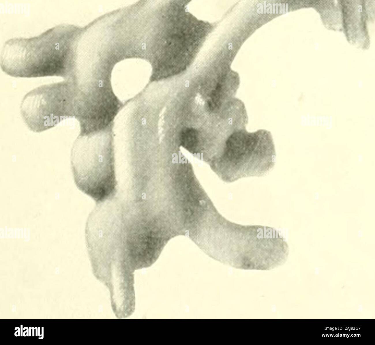 Stomach anterior view hi-res stock photography and images - Alamy