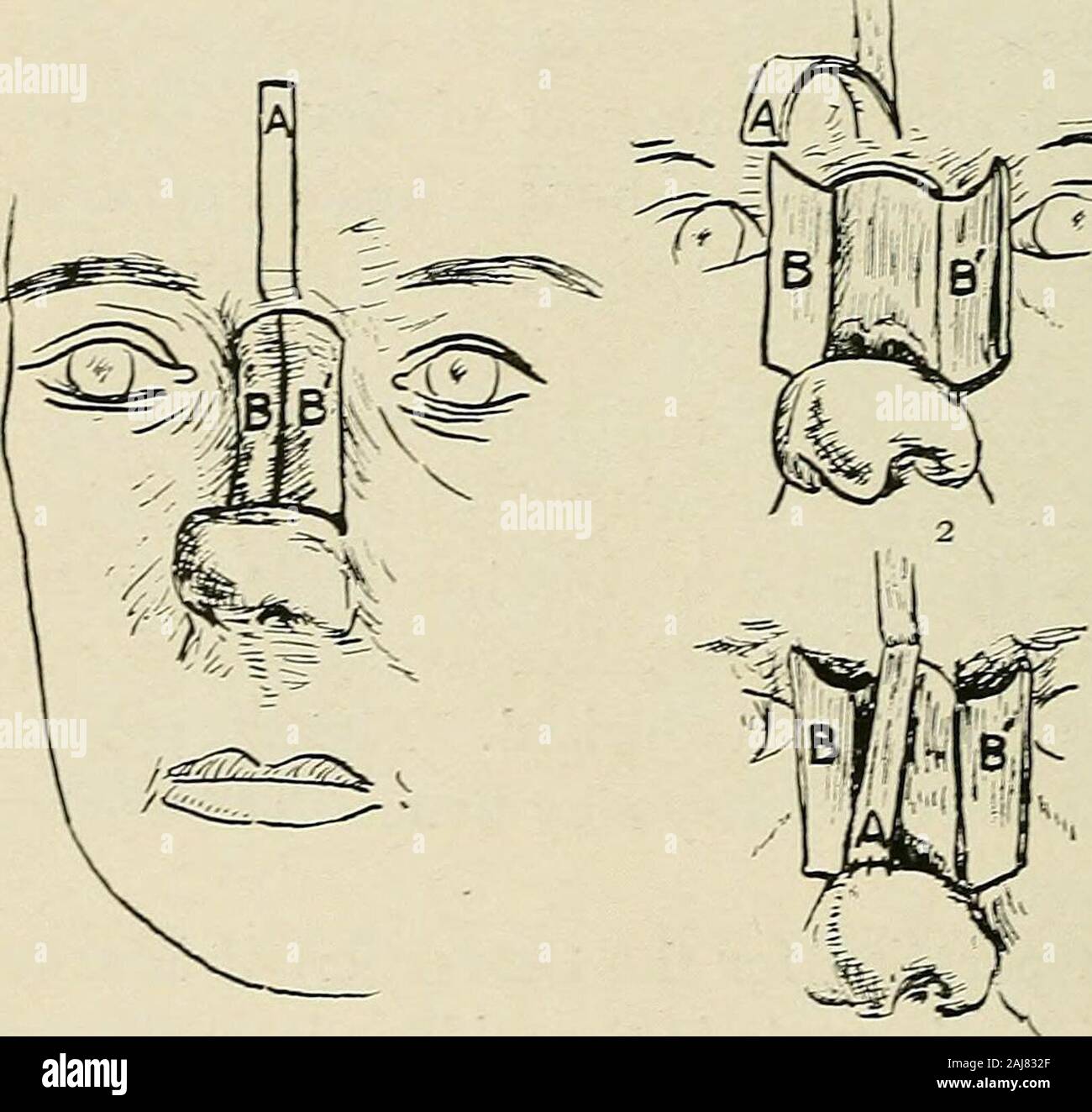 Plastic surgery; its principles and practice . en with a chiselthe ...