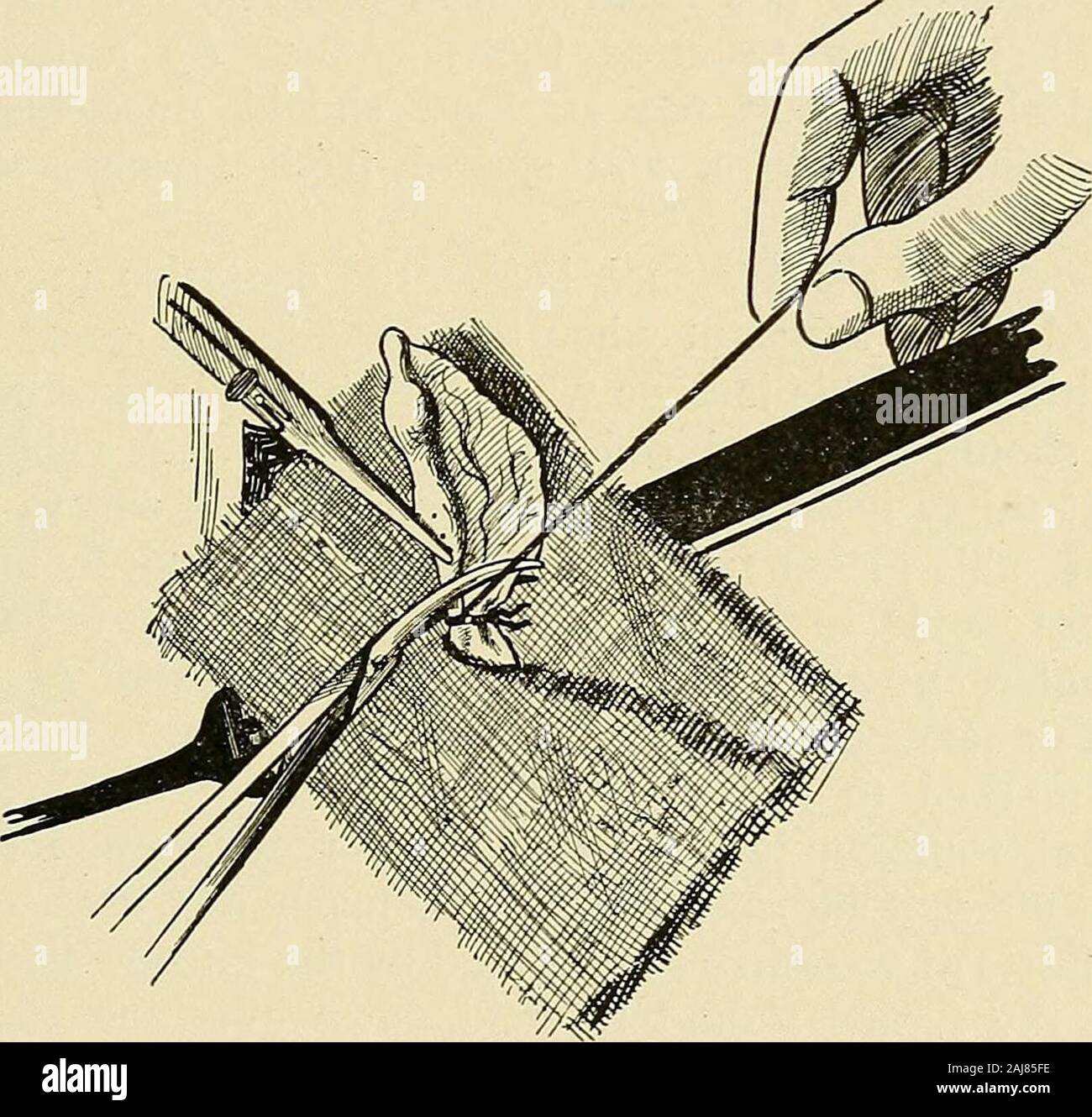 Stump appendicitis hi-res stock photography and images - Alamy