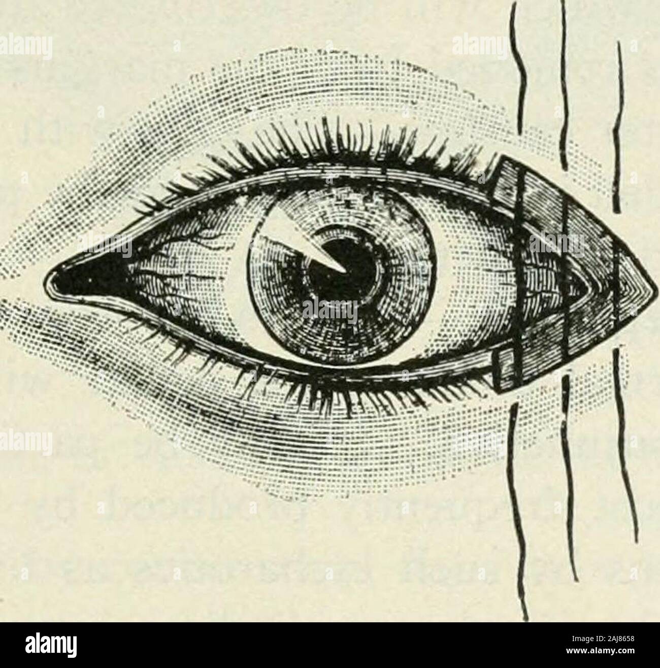 The commoner diseases of the eye : how to detect and how to treat them ...