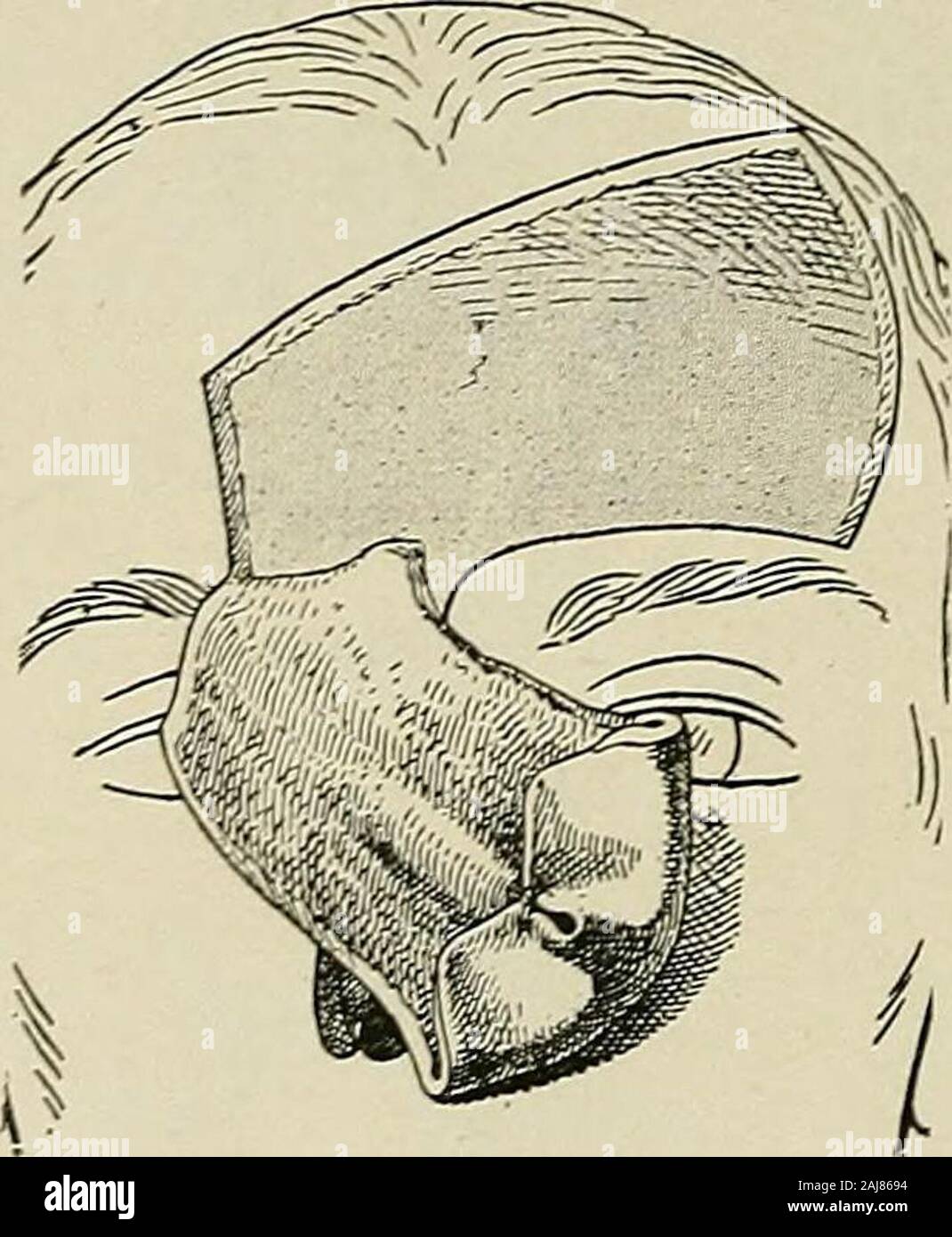 Rib Cartilage High Resolution Stock Photography and Images - Alamy