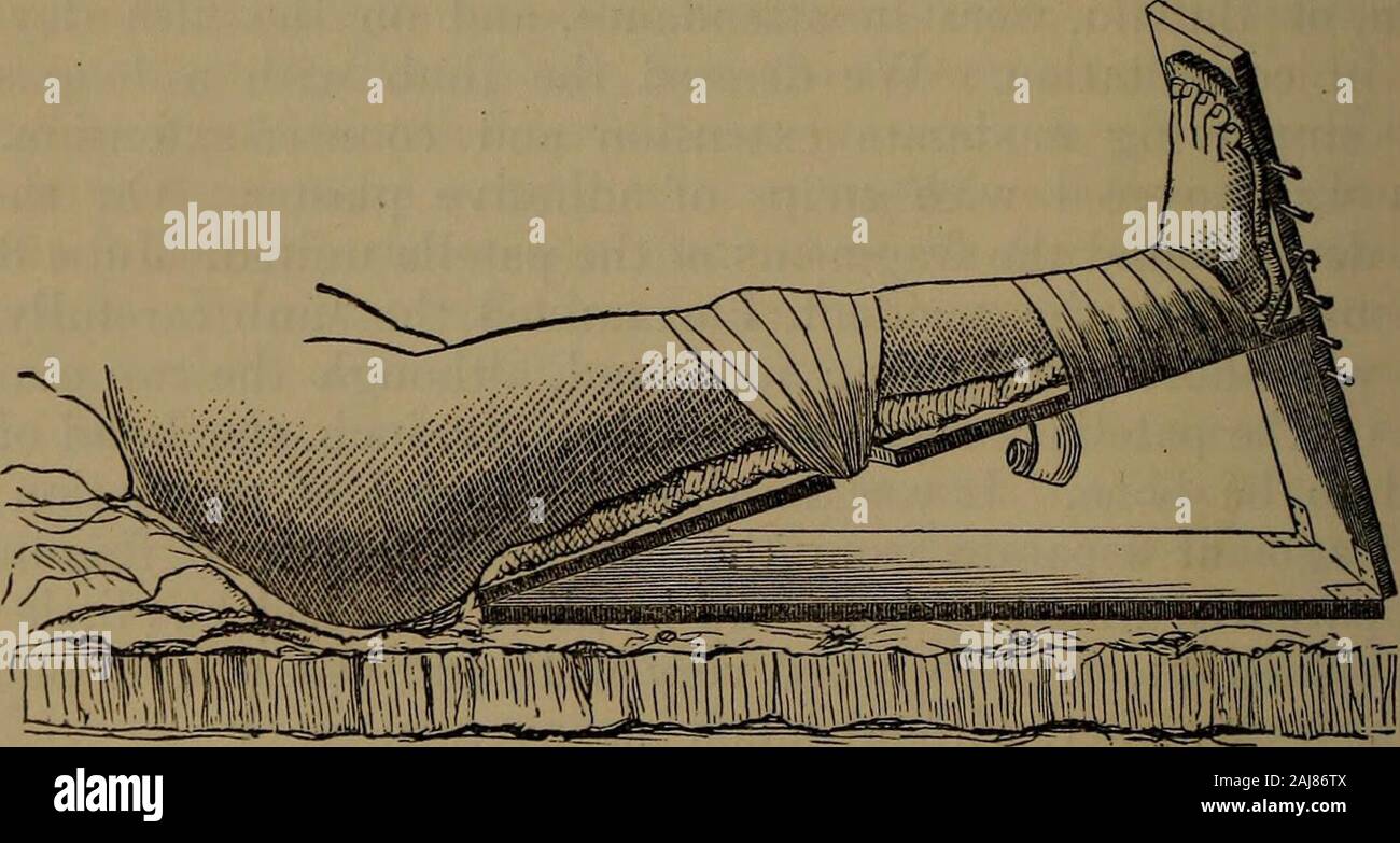 Grumous hi-res stock photography and images - Alamy