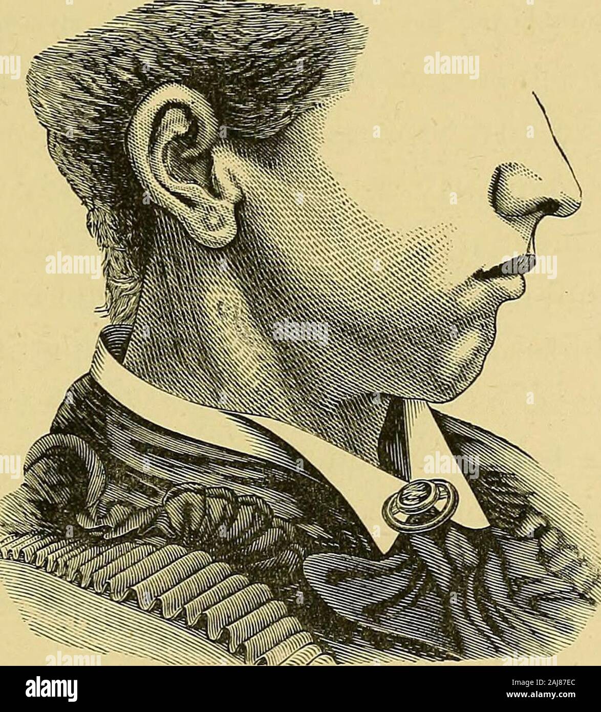 Neck abscess hi-res stock photography and images - Alamy