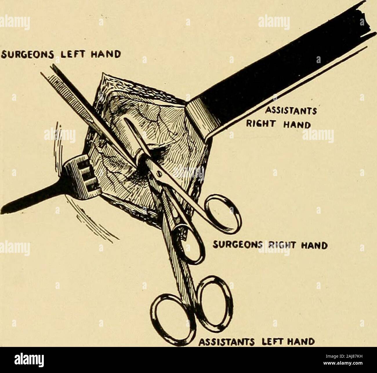 Parietal peritoneum hi-res stock photography and images - Alamy