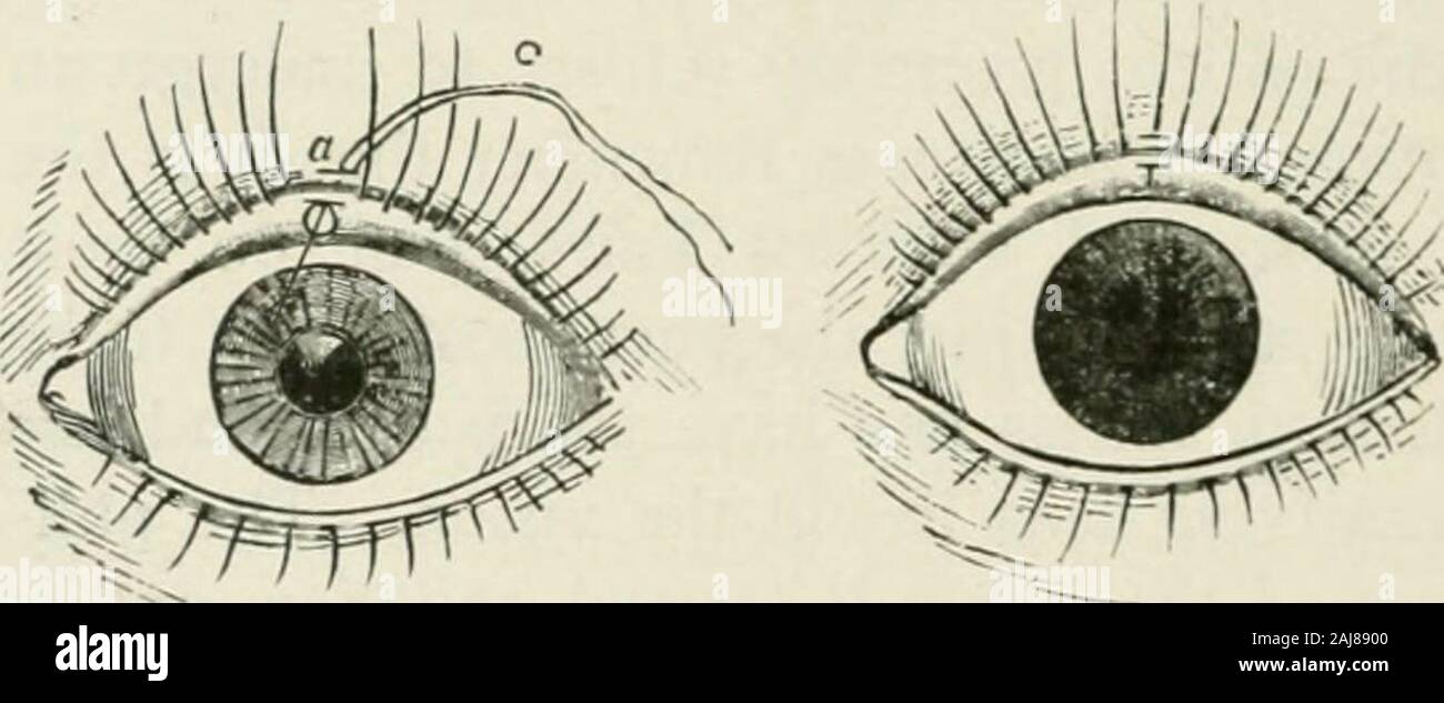 Kept in the loop hi-res stock photography and images - Alamy