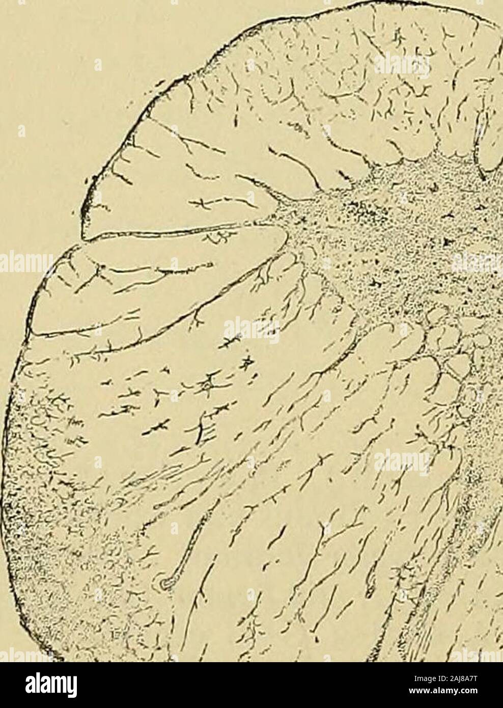 A manual of diseases of the nervous system . )(Troisier, Arch, de ...