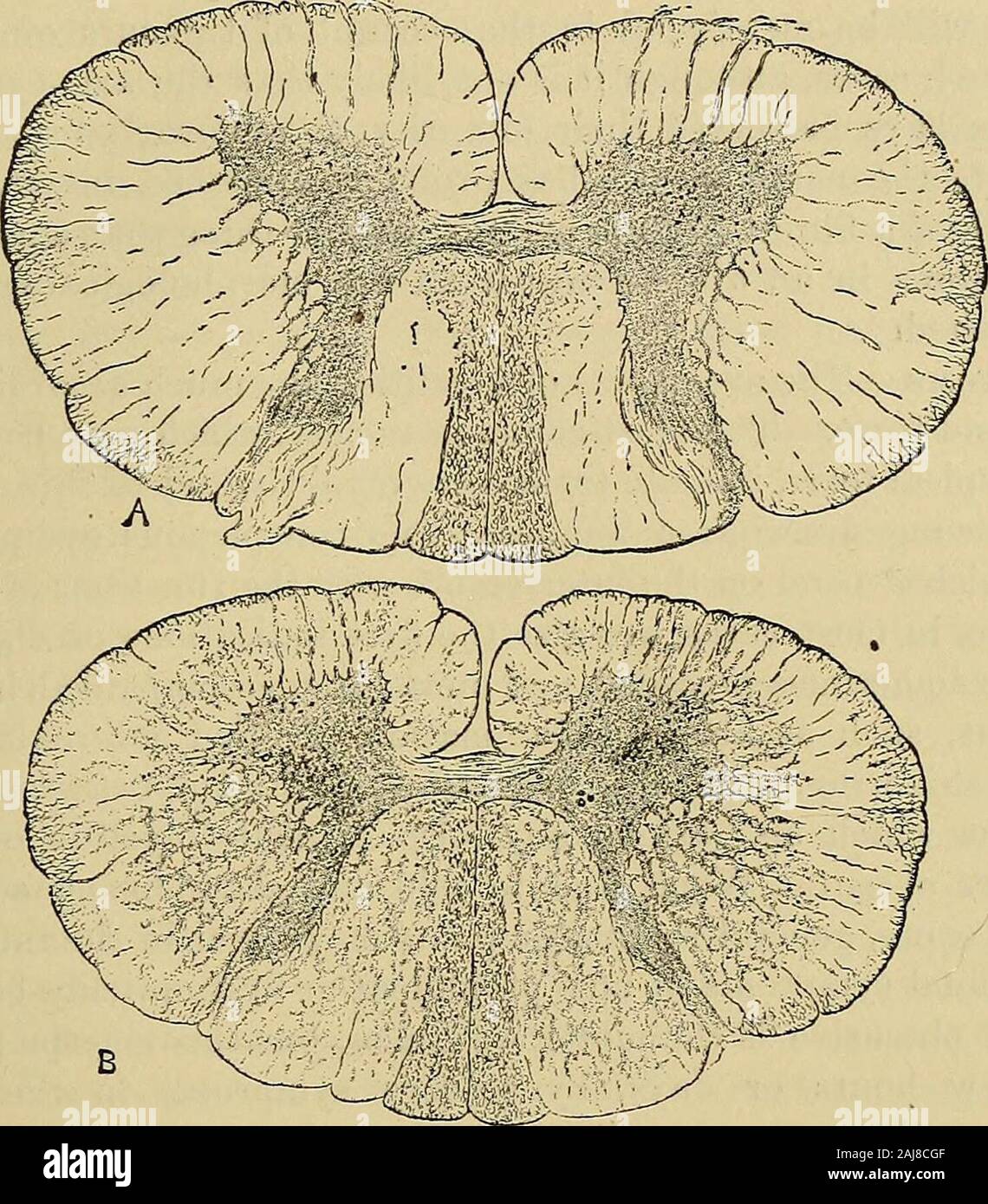 A manual of diseases of the nervous system . fibres are smaller than ...